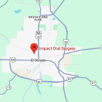 Oral Surgery El Dorado AR | Impact Oral Surgery